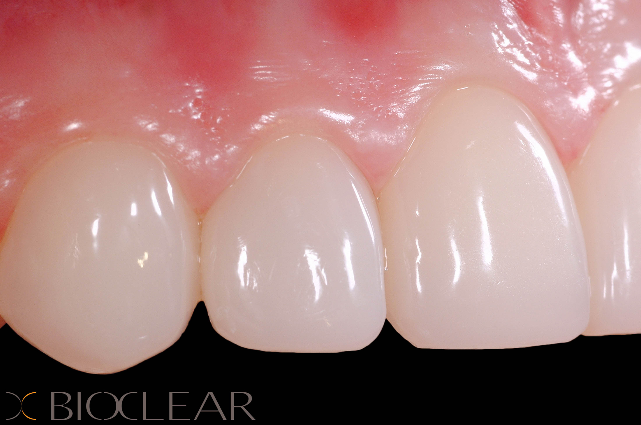 The Bioclear Method - The Tanshire Clinic